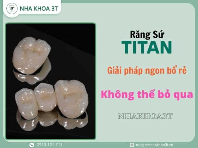Bọc Răng Sứ Titan Có Bị Đen Nướu Không?