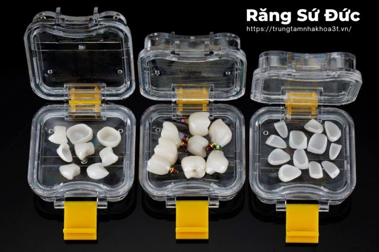 Các Loại Răng Sứ Đức, Lựa Chọn Tối Ưu Cho Nụ Cười Hoàn Hảo