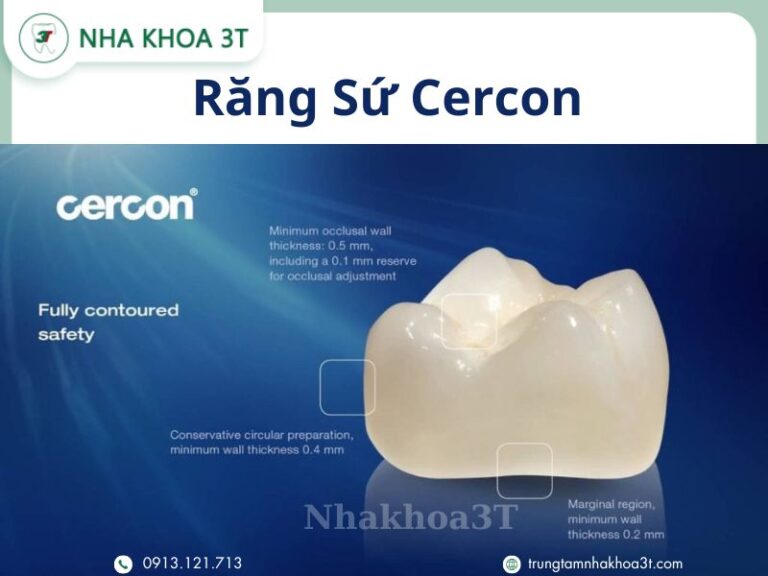 Răng Sứ Cercon Là Gì? Giá Răng Sứ Cercon Bao Nhiêu Tiền?